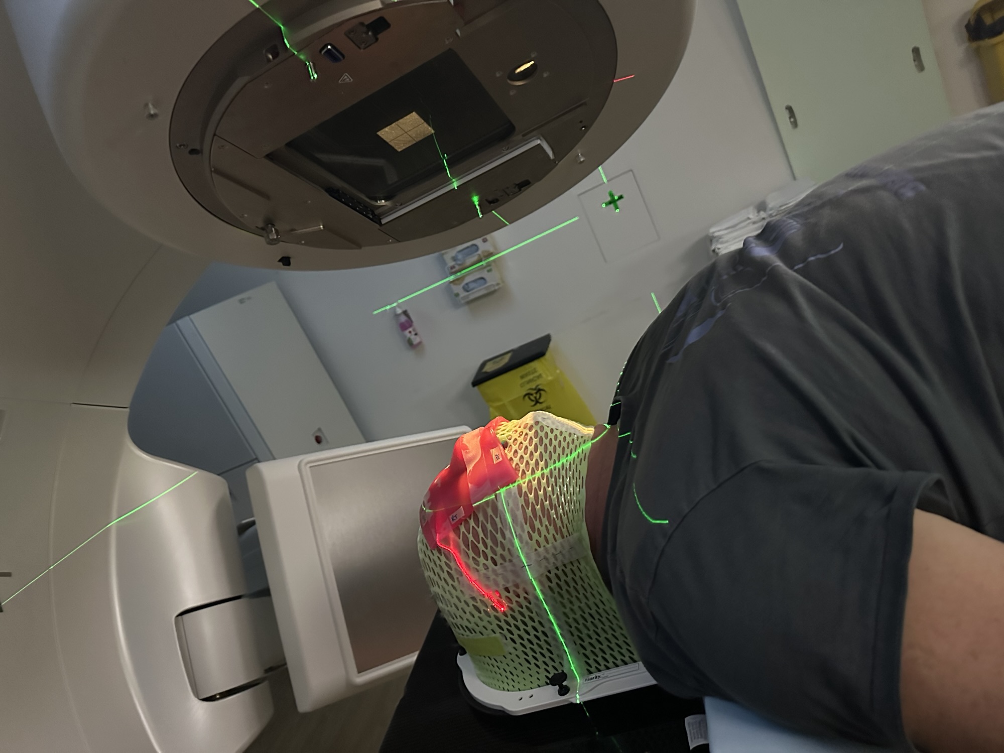 To scan or not to scan… – Katie OneEighty